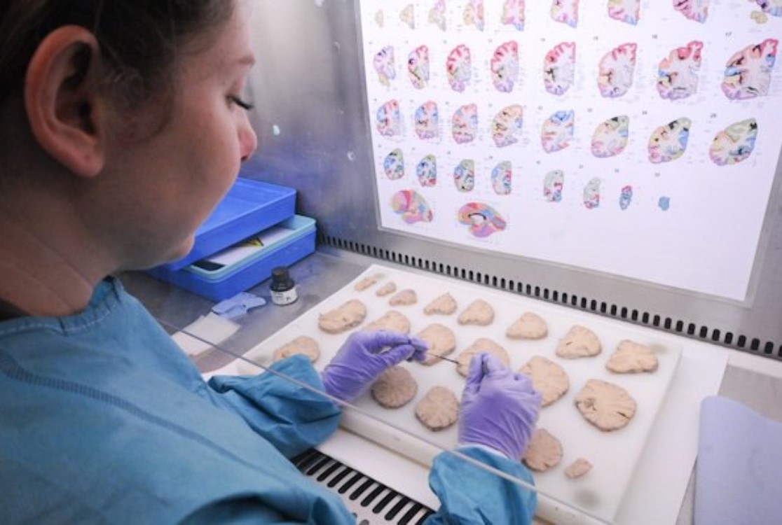 A look behind the scenes – how Alzheimer’s Research UK decides what ...
