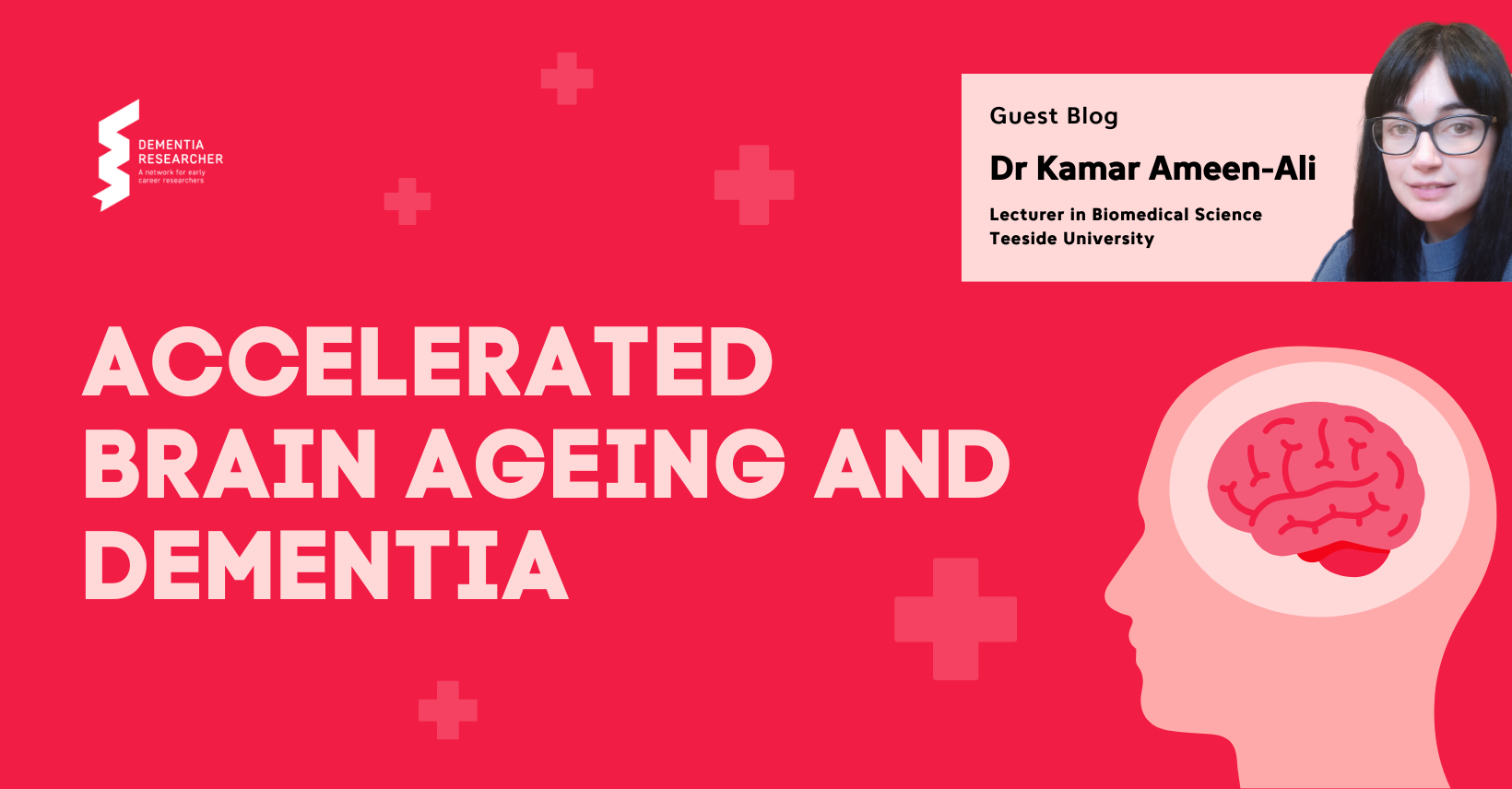 Blog – Accelerated brain ageing and dementia